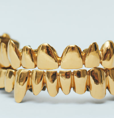 The Ancient History of Gold Teeth - Felix Paydirt's Gourmet Gold